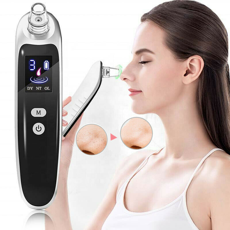 Electric Blackhead Remover Vacuum Acne Cleaner Black Spots Removal ...