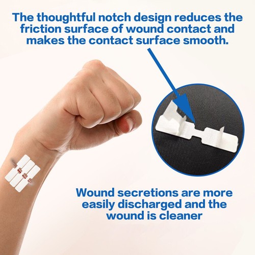 10Pcs Zipper Band-aid Painless Wound Closure Device Suture-free Wound ...