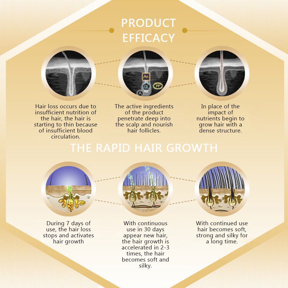 Andrea Hair Regrow Oil Growth Ginger Essence Hair Loss Serum Treatment ...