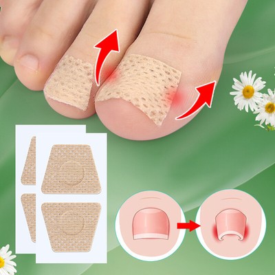 Nail Care Patch Ingrown Toenail Pad Orthopedic Patch Soft Nail Repair ...