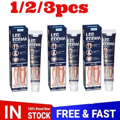 New 20g Anti Edema Cream Remove Arm Leg Swelling Pain Relief Ointment 1 ...