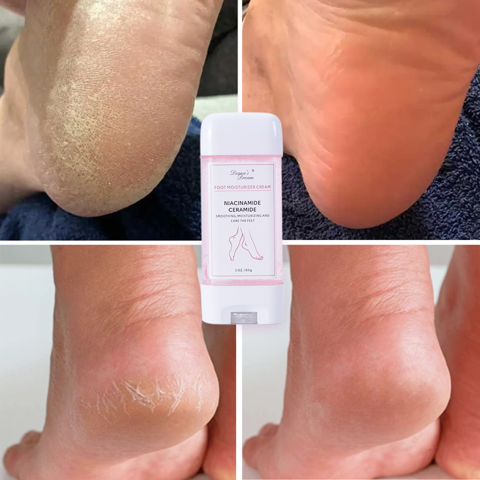 Foot Moisturizer Cream for Dry Cracked Heels and Feet Hydrate Rough ...