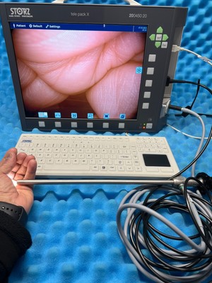 Video Endoscopes - Karl Storz Endoscopy