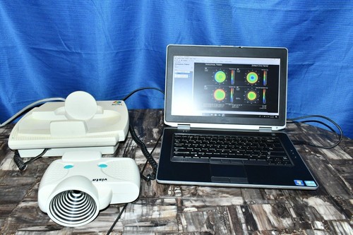 EyeSys Vista USB Portable Topographer with Win 10 Laptop and Eyesys ...