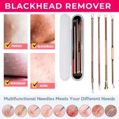 Pcs Pimple Popper Tool Blackhead Remover Kit Spot Acne Comedone ...