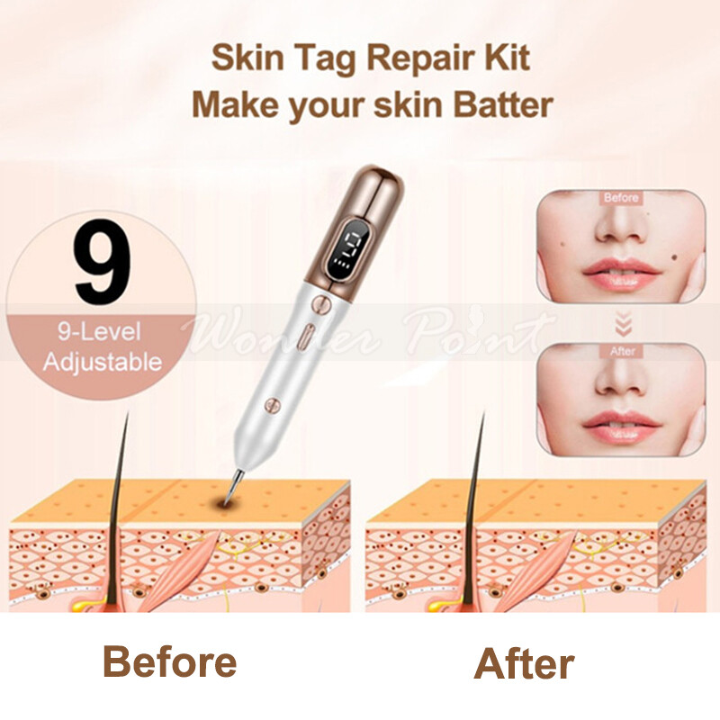 Skin Tag Freckle Wart Dot Mole Remove Pen Dark Spot Tattoo Removal ...