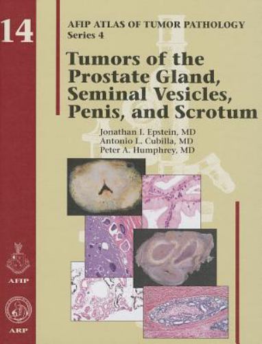Tumors of the Prostate Gland, Seminal Vesicles, Penis, and Scrotum ...