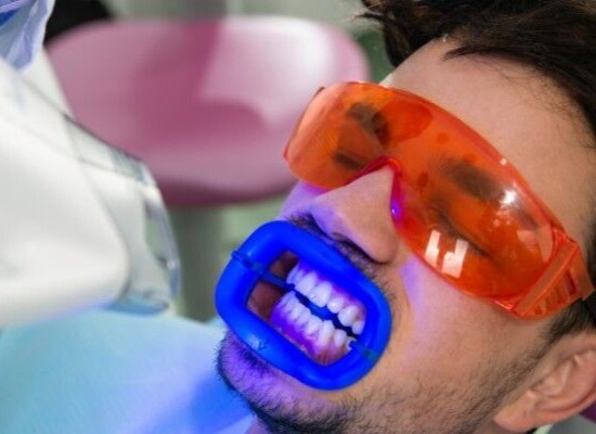 3pc Dental Teeth Whitening Mouth Prop Opener Cheek Retractor Props ...