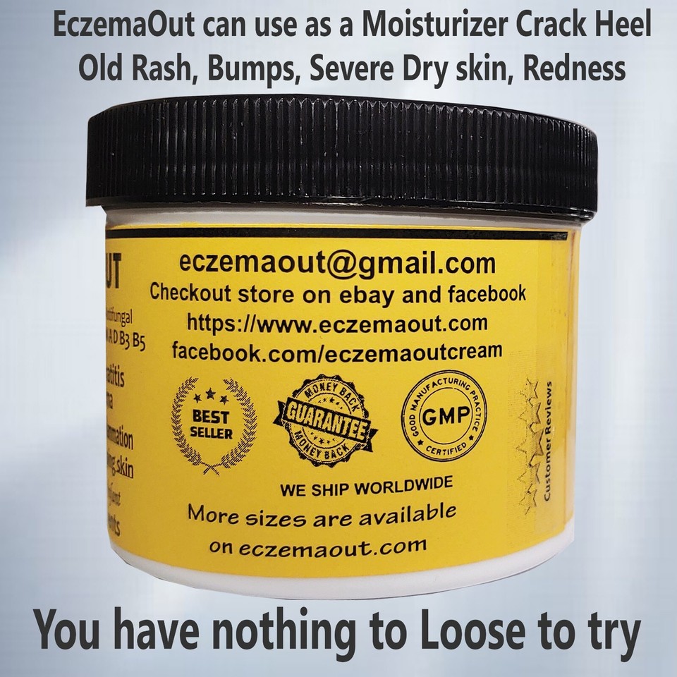 Perioral Dermatitis Cream | Redness & Itch Relief | Non-Steroidal ...