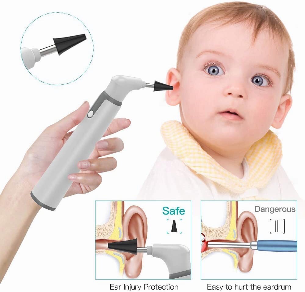 Wireless Otoscope Ear Camera with Dual View, 3.9Mm 720PHD Wifi Ear ...