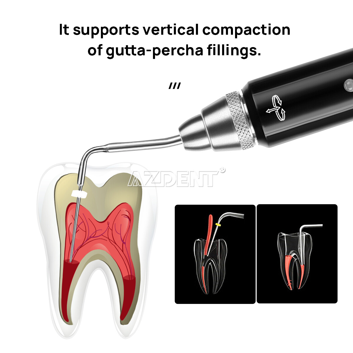 Gutta Percha In Tooth