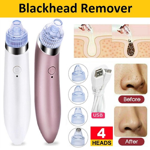 Electric Blackhead Remover Vacuum Facial Skin Pore Acne Pimple Cleaner ...