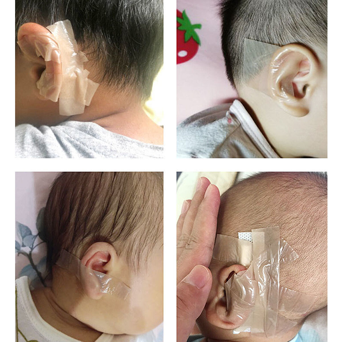 Ear Aesthetic Correctors Newborn Baby Ear Patch Stickers Infant ...