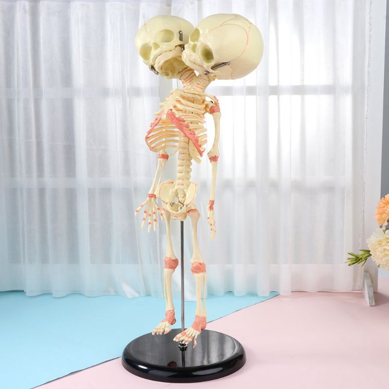 37cm Human Double for Head Baby Skull Skeleton Anatomy Brain Display ...