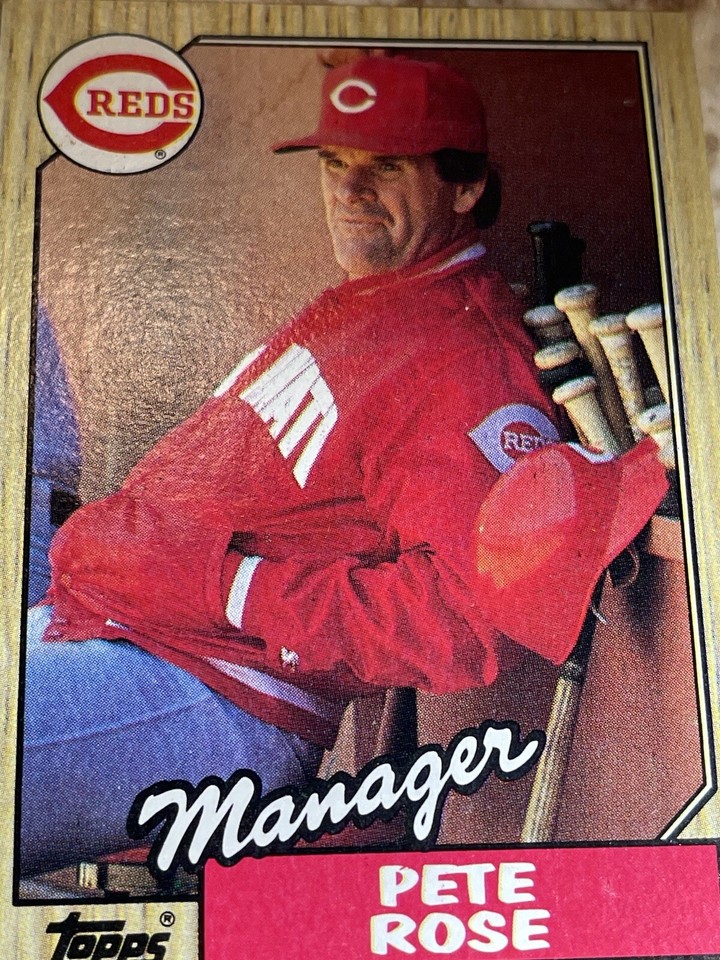 1987 Topps Pete Rose Cincinnati Reds #393 RARE ERROR Baseball Card | eBay