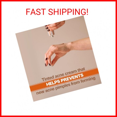 Adult Acnomel Acne Medication Cream, 1.3 Ounces | eBay