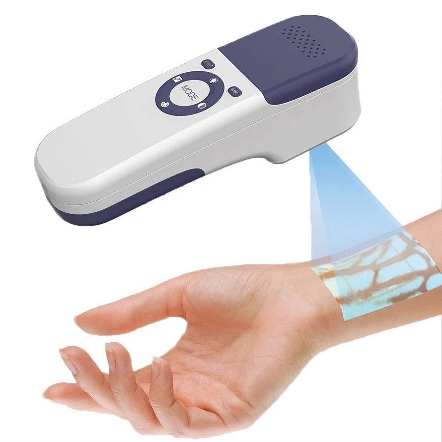 Infrared Vein Finder - Handheld Vein Detector for IV, Medical ...
