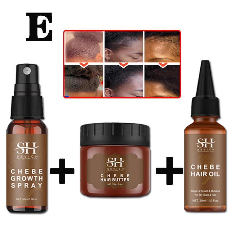 Sevich Chebe Hair Loss Treatment Spray Traction Alopecia Chebe Powder ...