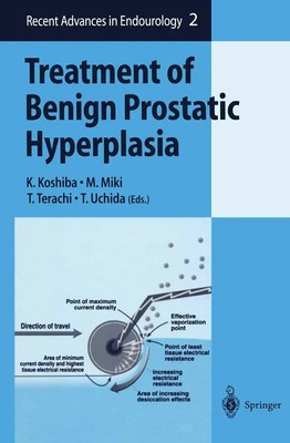K. Koshiba (u. a.) | Treatment of Benign Prostatic Hyperplasia ...