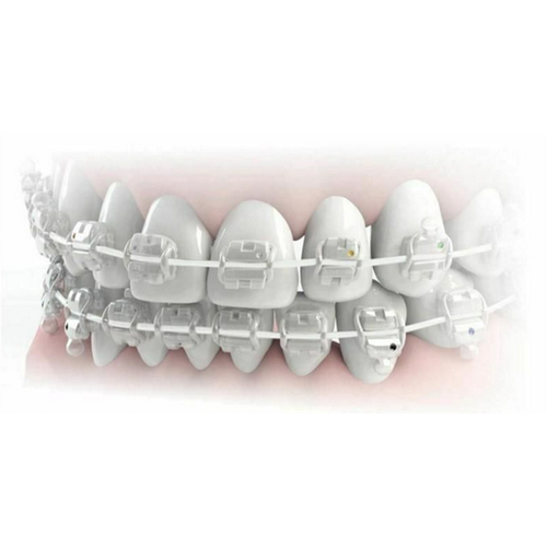 1pcs Dental Morelli NiTi Aesthetic SuperElastic Archwire Round Upper ...