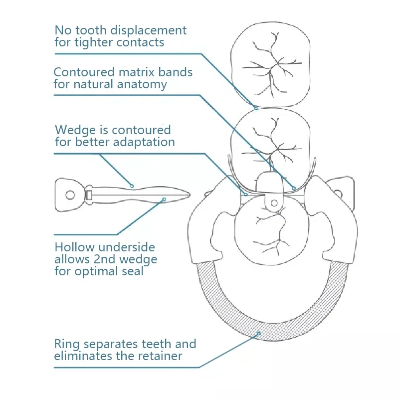 Dental Matrix Bands Ring Sectional Matrice Clamp Fit Garrison Palodent ...