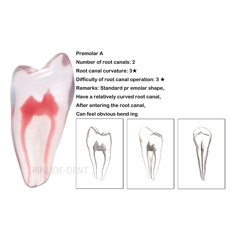 Dental Resin Root Canal Teeth Model Endo Practice Block RCT Pulp Cavity ...