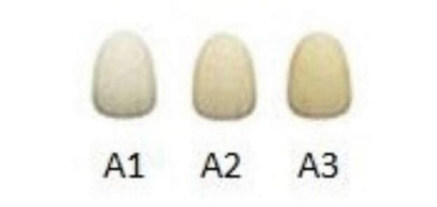 Flipper Upper and Lower Set of Affordability Flexible Valplast Partial ...