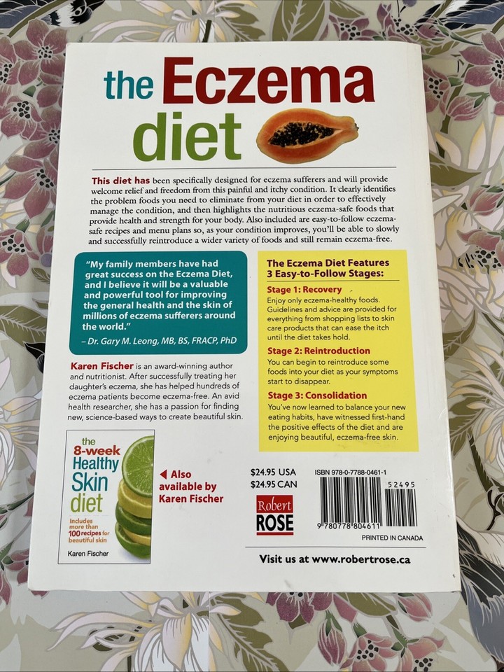 The Eczema Diet: Discover How to Stop and Prevent The Itch of Eczema ...