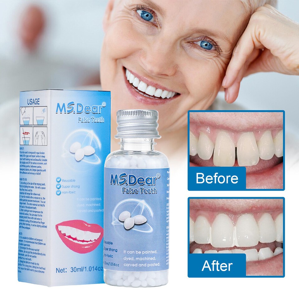 2PCS False Teeth Solid Glue Temporary Tooth Gap Filler Tooth Repair ...