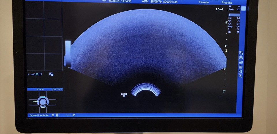 Ge ultrasound probe BE9CS-D | eBay