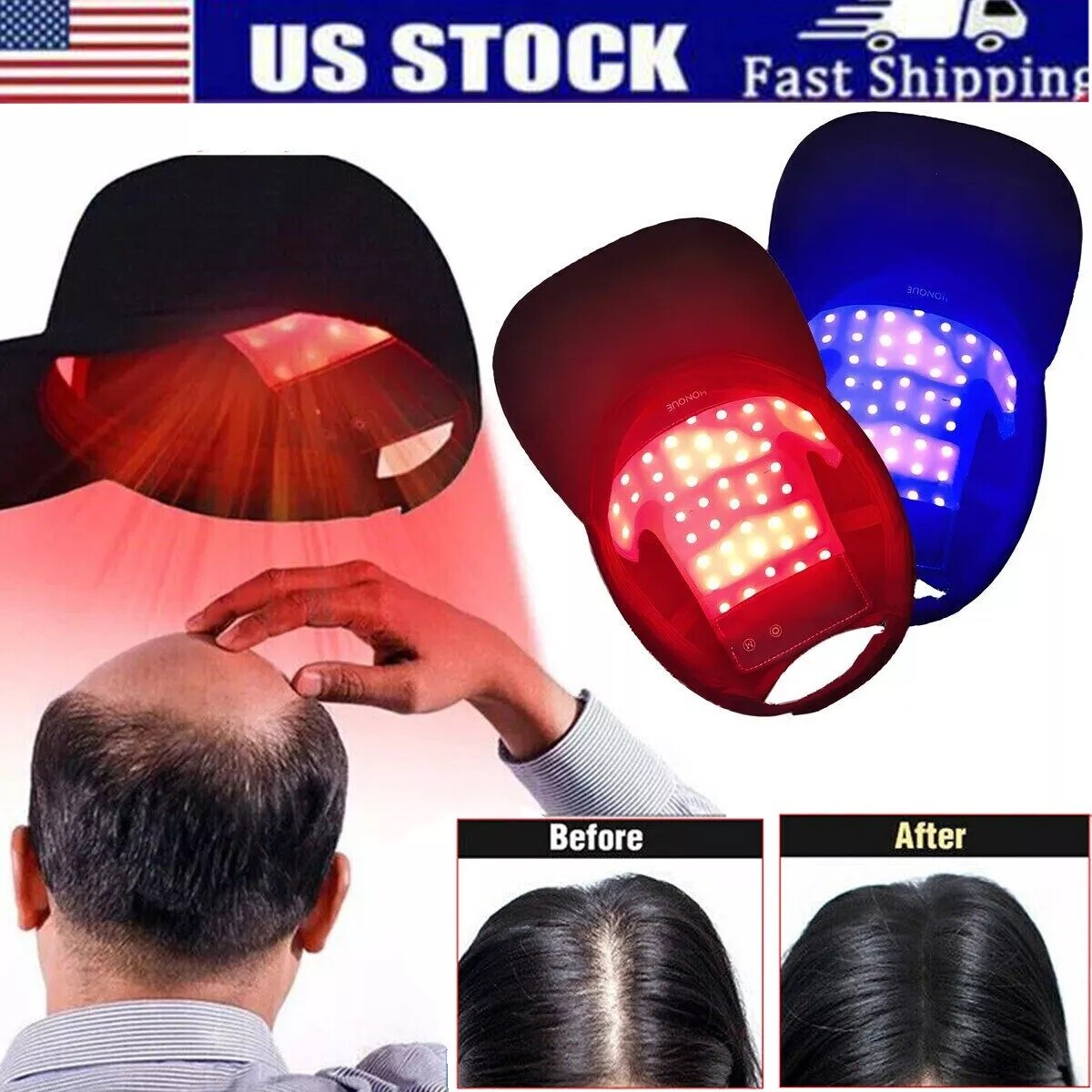 Red Light Therapy Hair Regrowth Searching For Ways To Optimize Your