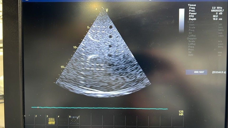 GE Vivid E95 V204 Cardiac Ultrasound Machine with M5Sc-D - Biomed ...