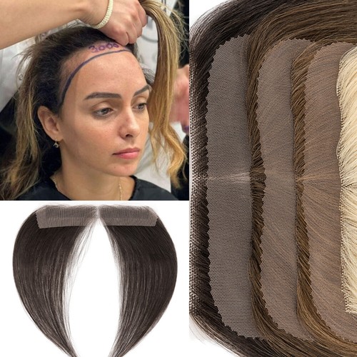 Receding Hairline Full Lace Cover Up Remy Human Hair Patches Pieces ...