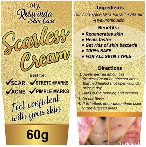 Lot 2 Syringoma Cream Remove Syringoma Scarless Cream Fade and Lighten ...