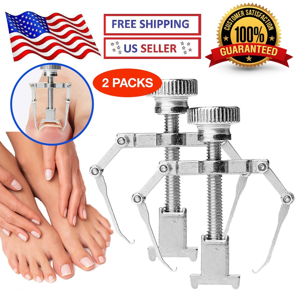 Ingrown Toe foot Nail Correction Fixer Nail Pedicure Tool Toenail ...