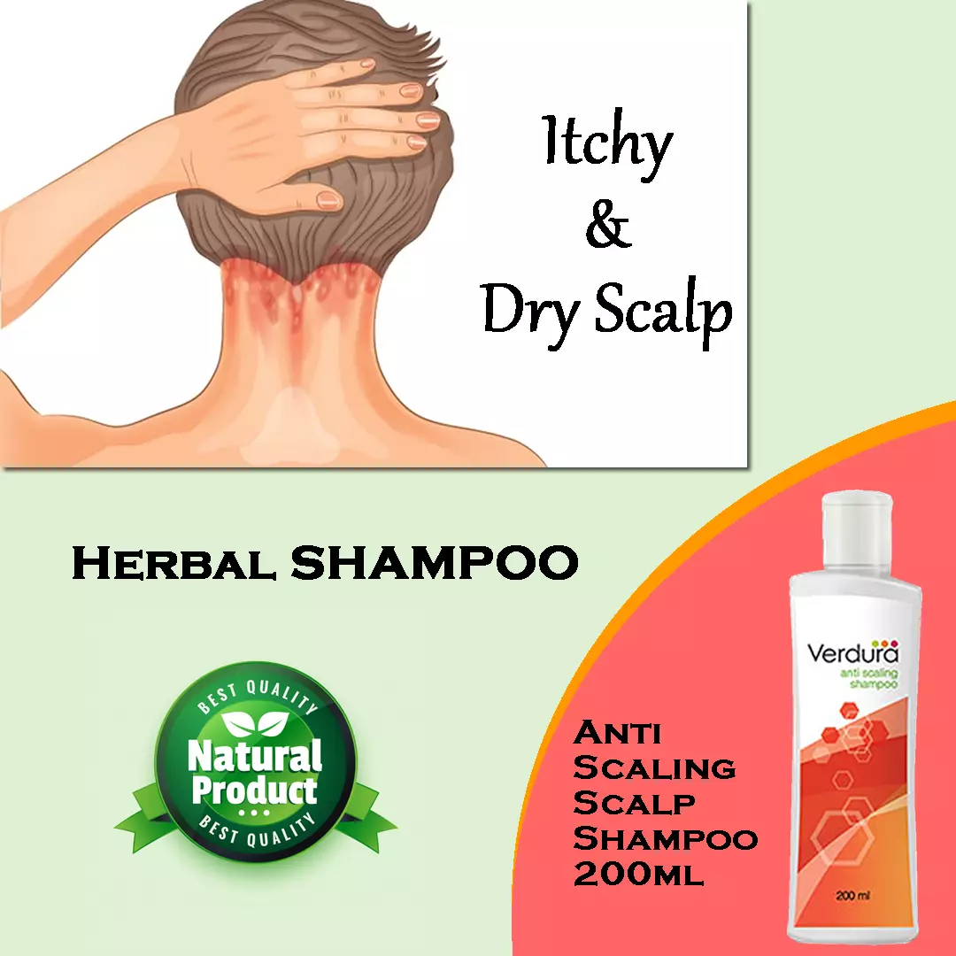 Itchy Scalp Shampoo Itchy Scalp Shampoo