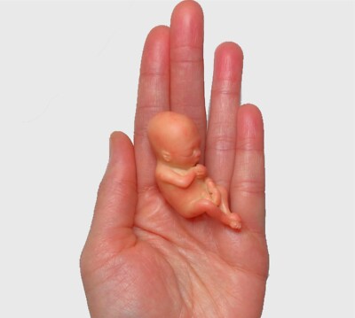 12 Weeks Baby Fetus, Stage of Fetal Development (Memorial/Miscarriage ...
