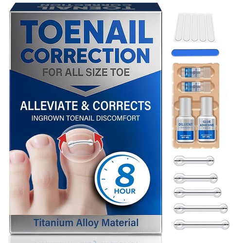 Ingrown Toenail Treatment, Toenail Correction Strips for Curved or ...