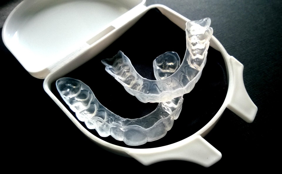 Teeth Whitening / Bleaching Trays Custom Fit | eBay UK