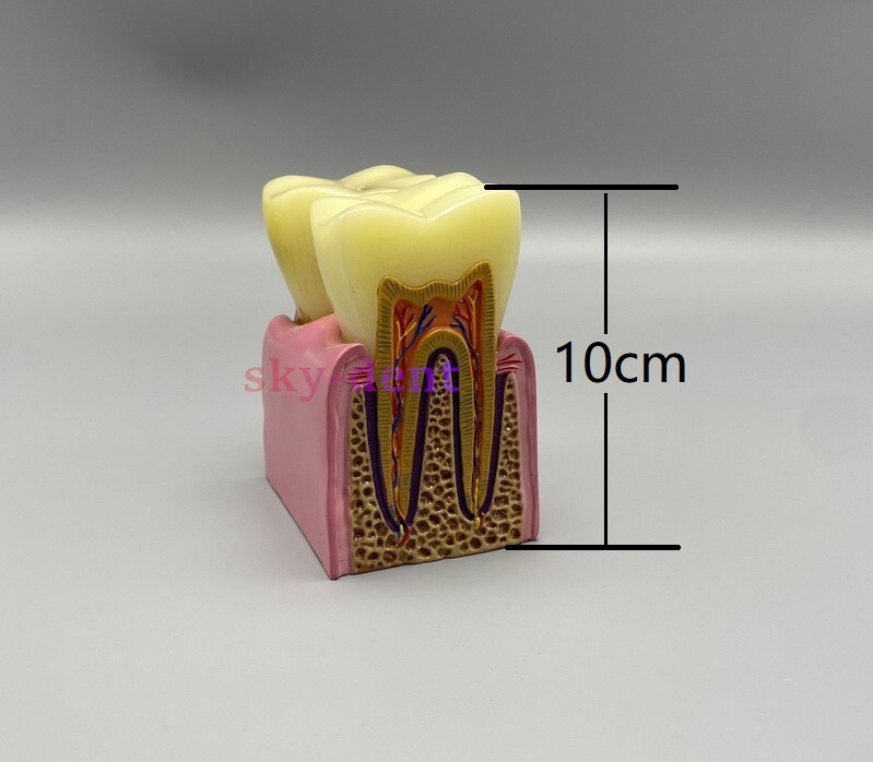 Dental Typodont Teeth Model Ortho Implant Pathological Perio Practice ...