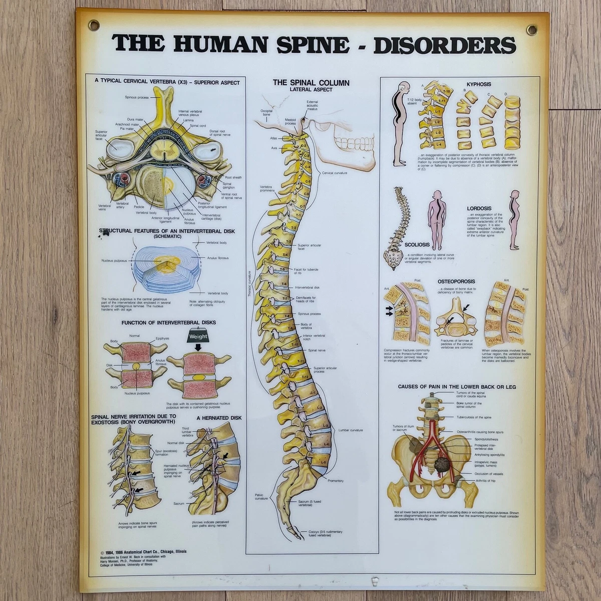 Human Spine Disorders