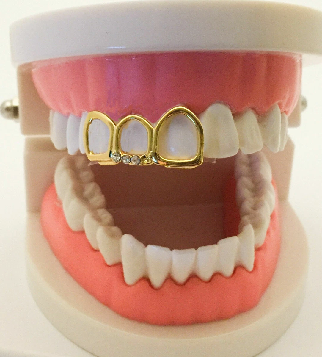 Gold Front Tooth