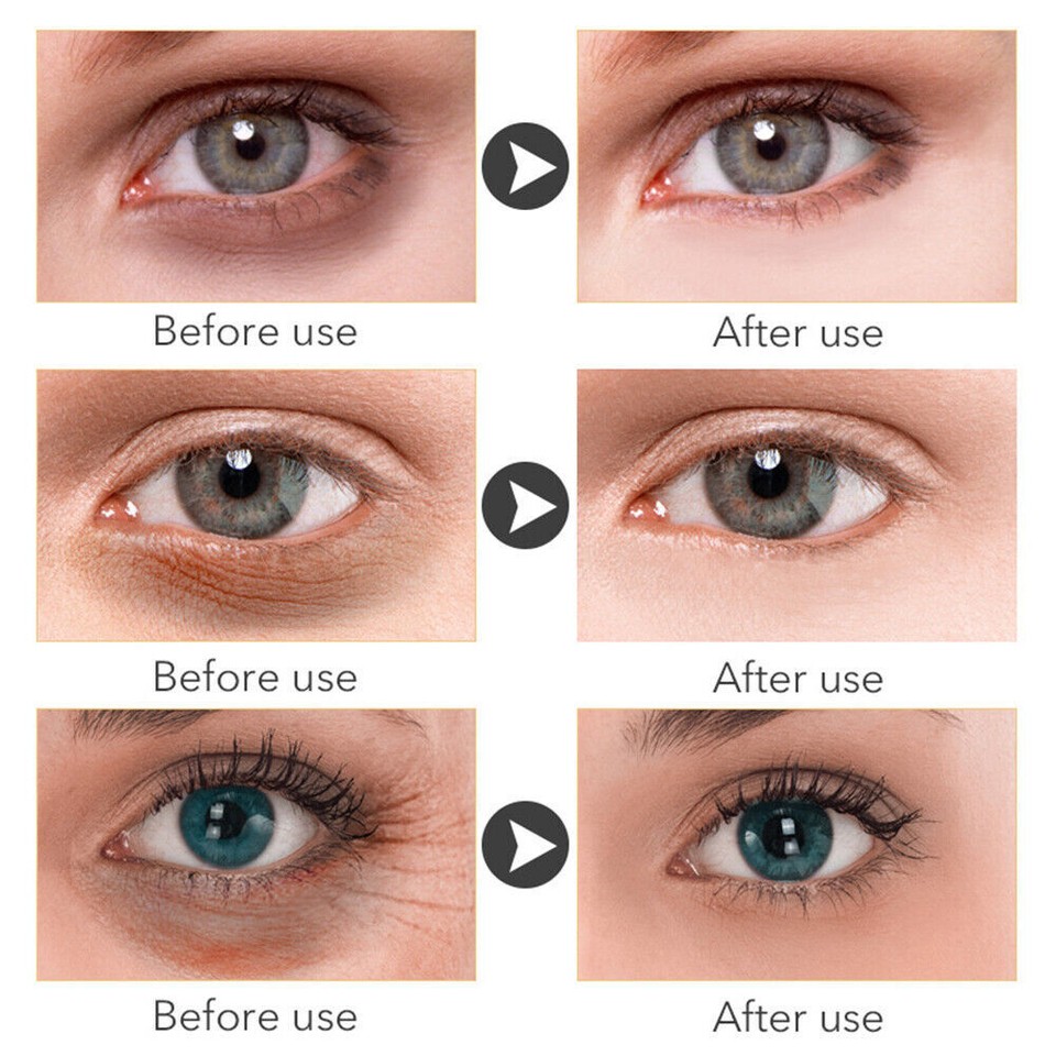 3X Cayman Eye Cream Instant Eye Bags Dark Circles Removal Anti ...