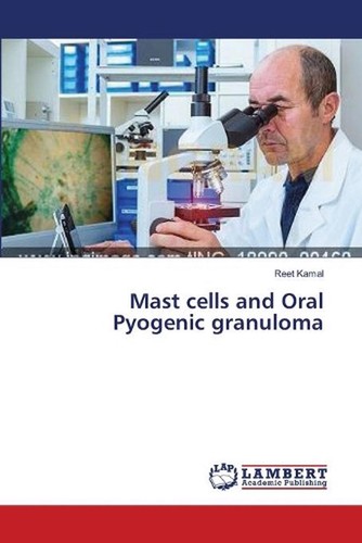 Mast cells and Oral Pyogenic granuloma by Reet Kamal (English ...
