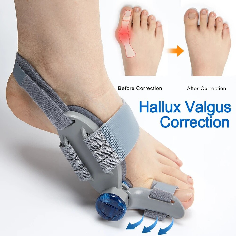 Bunion Fix Toe Valgus Corrector Big Toe Straightener Bunion Correction ...