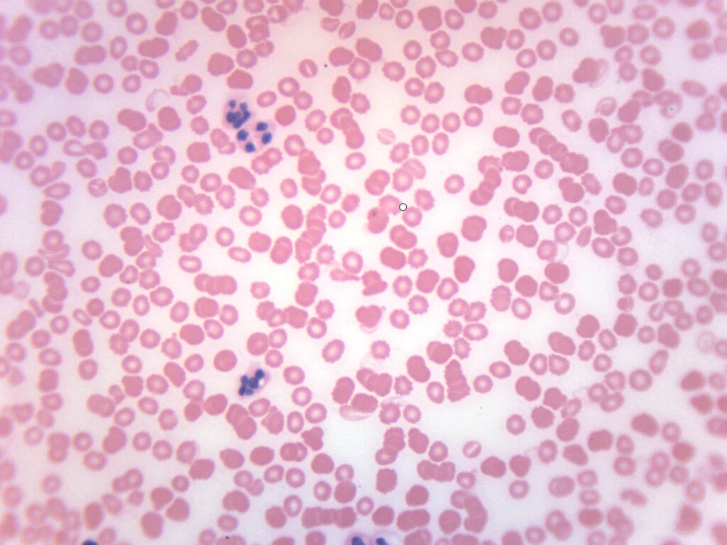 Microscope Slides Of Blood Cells