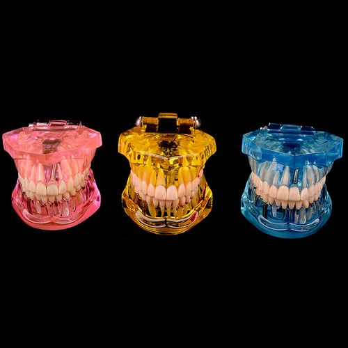 Dental study teeth model transparent adult pathological disease tooth ...