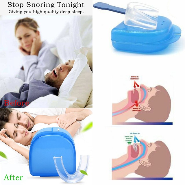 Anti Snore Mad Mandibular Advancement Device Apnea Bruxism Stop Snoring ...