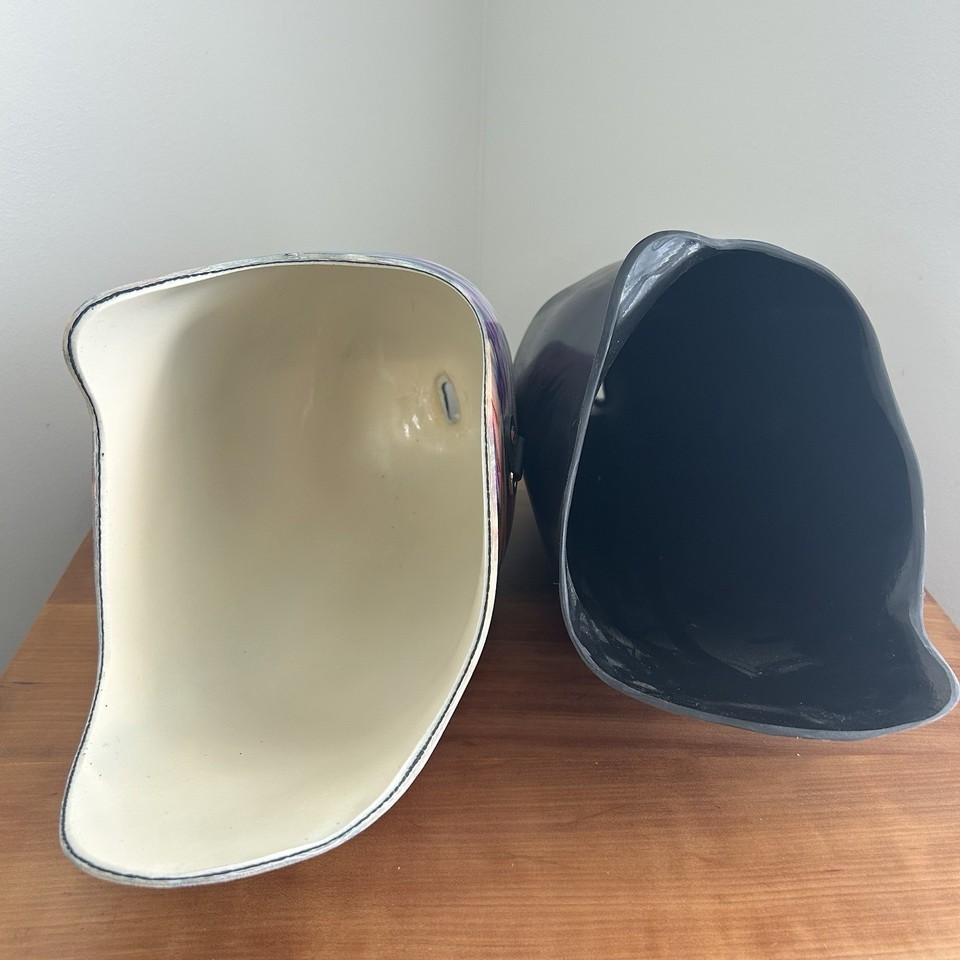 Prosthetic Above The Knee Stubbies Trulife Right And Left Leg With ...