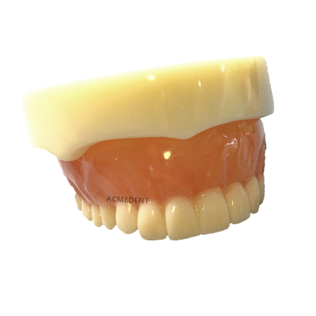Dental Full Denture Model Overdenture Magnetic Attachment Mandibular ...